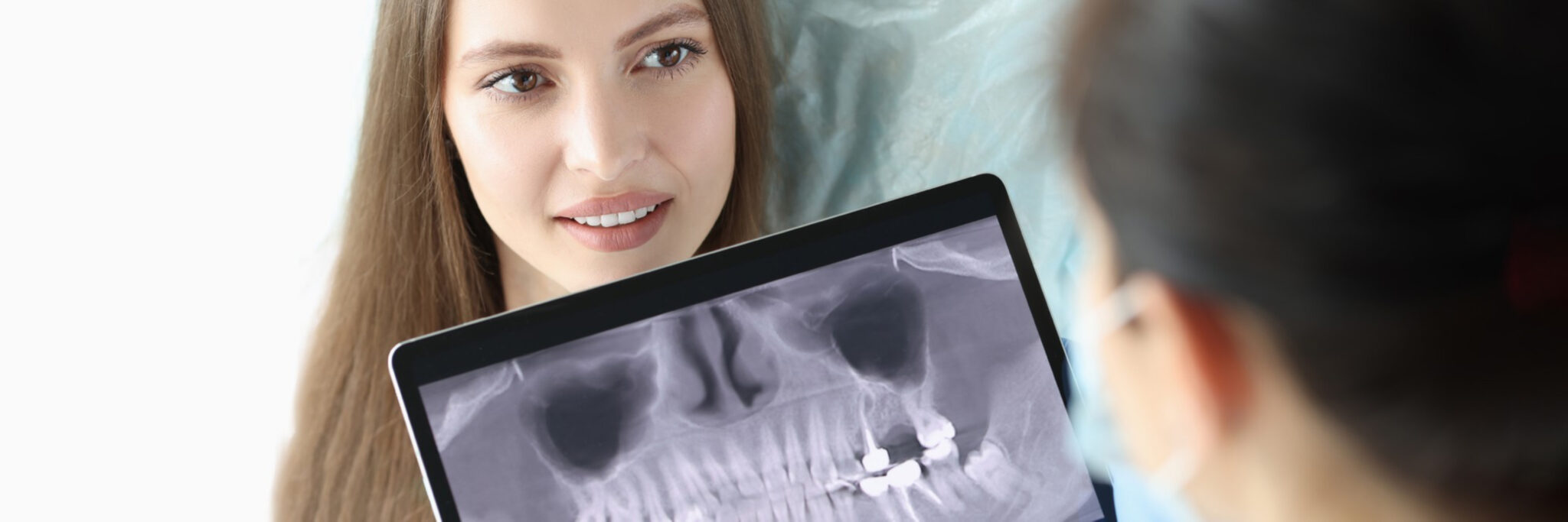 Dental Xrays and Imaging